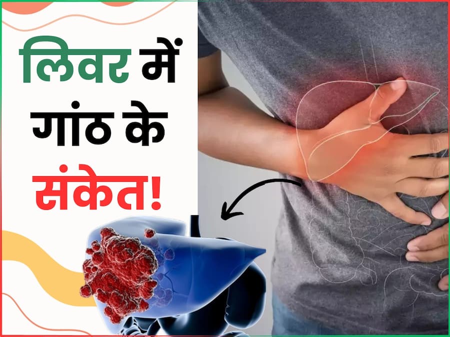 Liver me Ganth ke lakshan | लिवर में गांठ होने पर शरीर में दिखने लगते ...