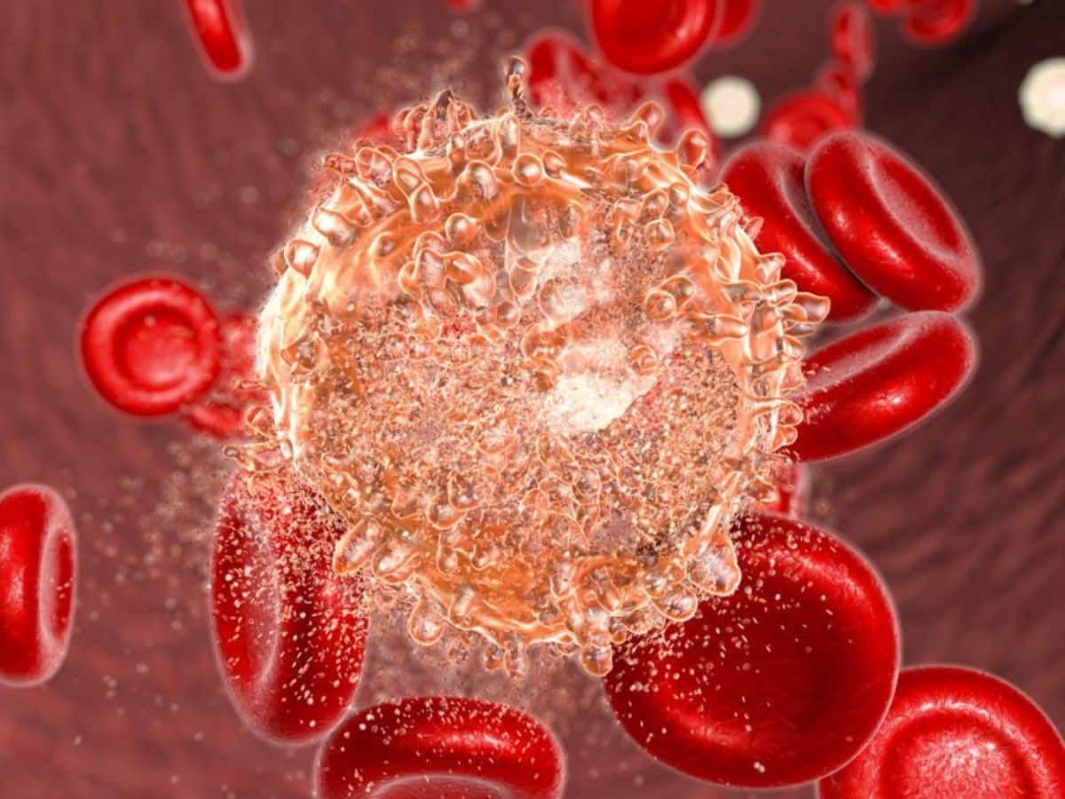 Why Men Are At A Higher Risk Of Leukemia Than Women | TheHealthSite.com