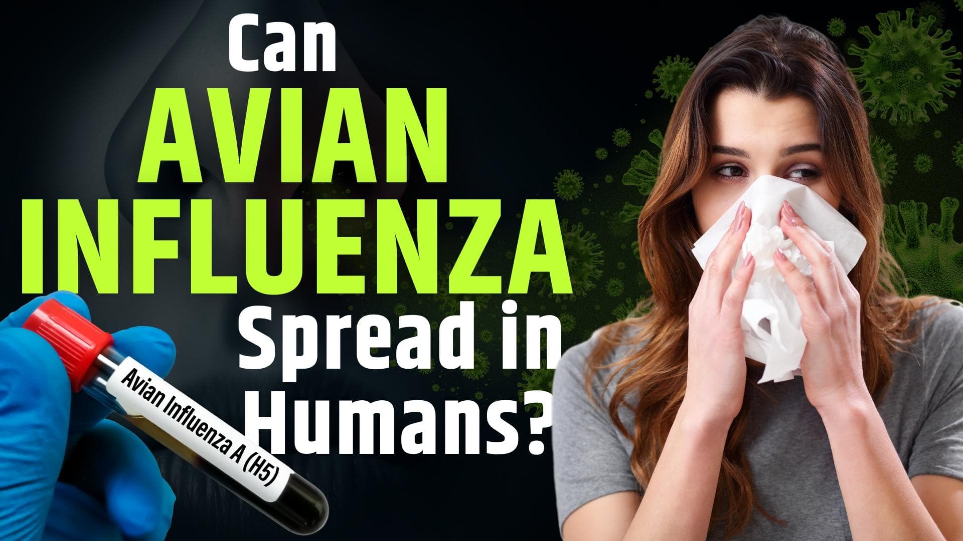 Influenza A Virus: A Highly Contagious Viral Infection