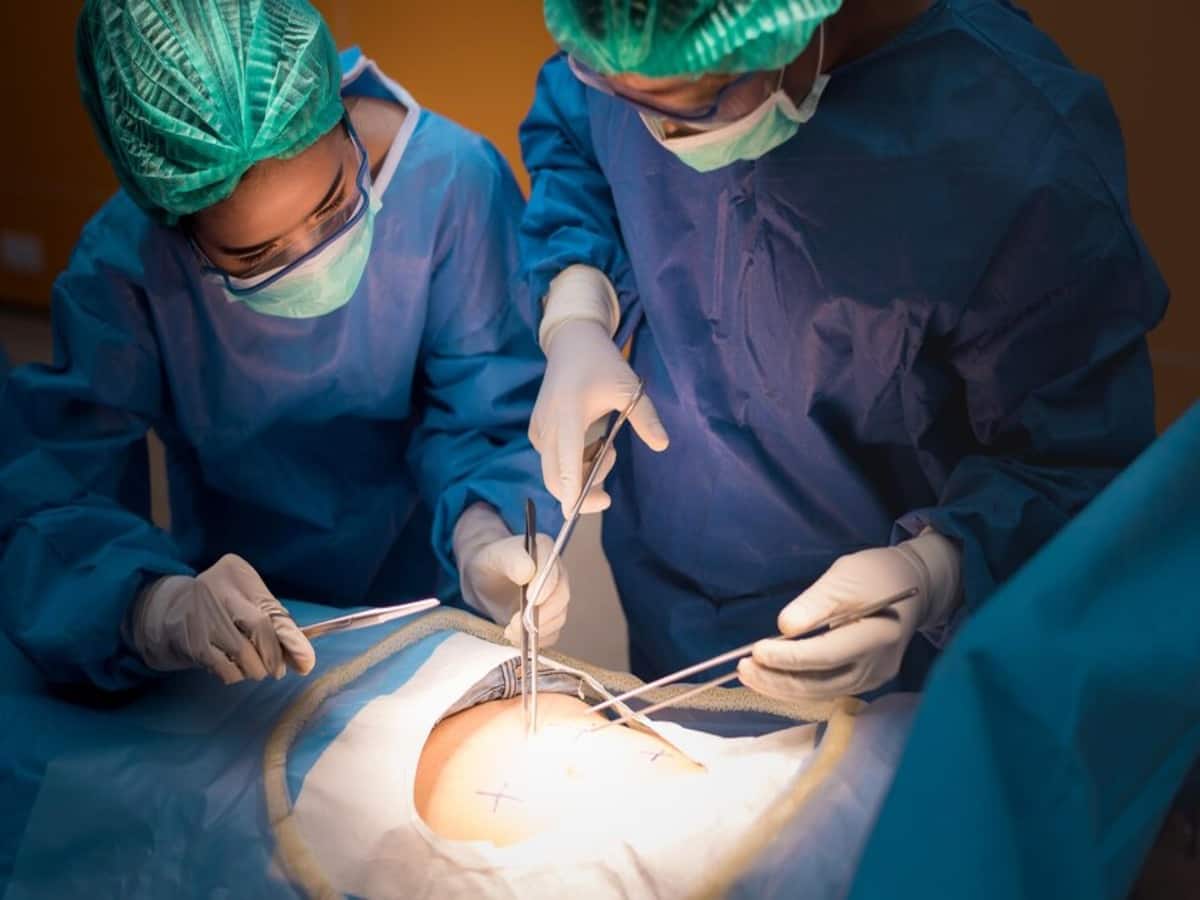 Massive Spleen Removed From A Man's Body After 17 Years Of Pain ...