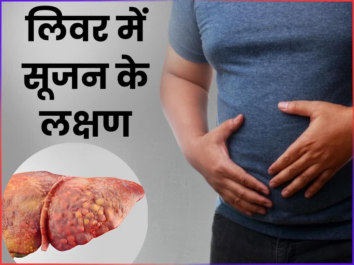 Liver Me Sujan Hone Ke Lakshan | इन 6 संकेतों से समझ जाएं लिवर में हो ...