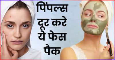 Pimples Ke Liye Face Pack | ऑयली स्किन पर पिंपल्स क्यों होते हैं? चेहरे ...