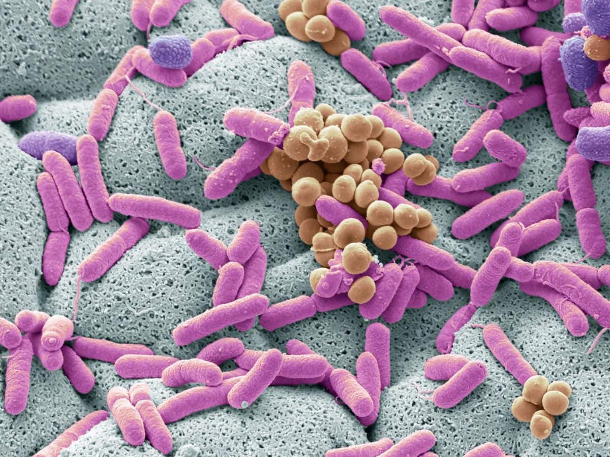 Rare Flesh-Eating Bacteria That Can Kill You In 48 Hours Spreading ...