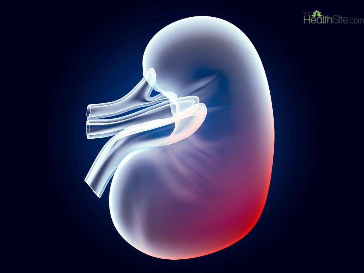 Kidney Cancer: 5 Unhealthy Practices You Must Stop Right Now To ...