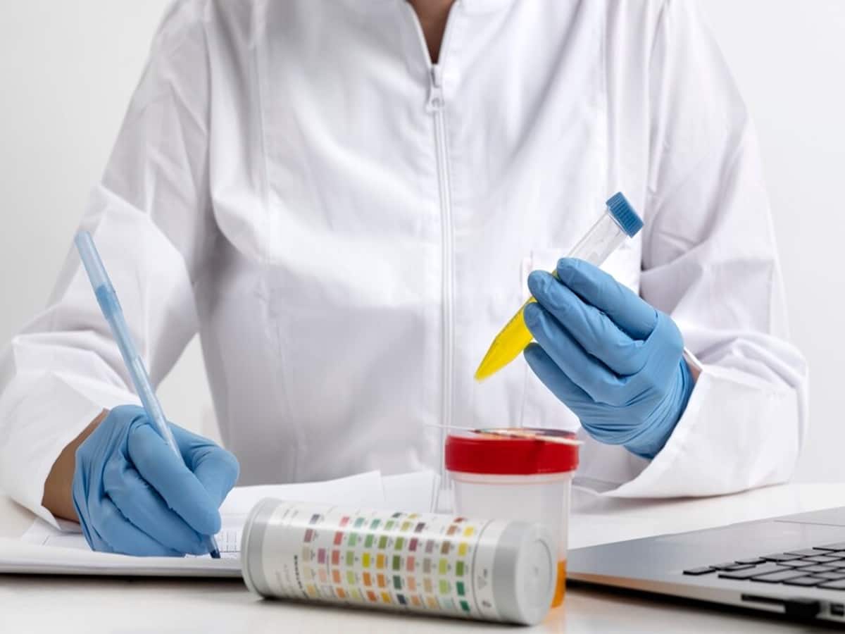 Uric Acid Prevention Tips For People Above 60 Note These 6 Symptoms And Factors
