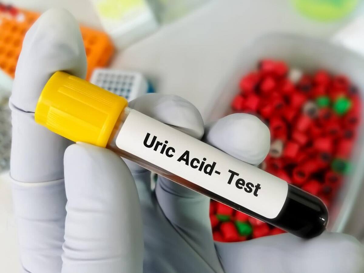 Tips To Reduce Uric Acid Levels Naturally: 5 Reasons Why Exercise Can ...