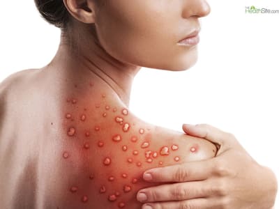 Are You Suffering From Vitamin B6 Deficiency? Look Out for These 7 ...