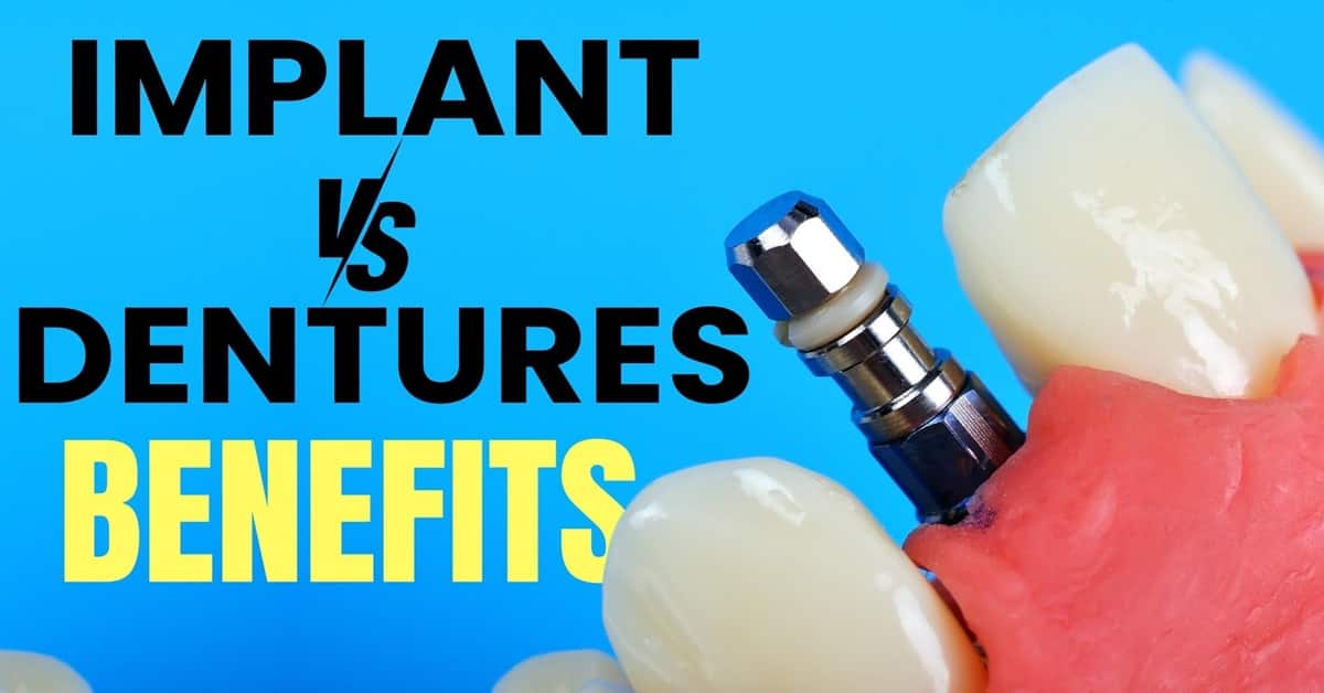 Fixed Dental Implants vs. Removable Dentures: Choosing the Right Option ...