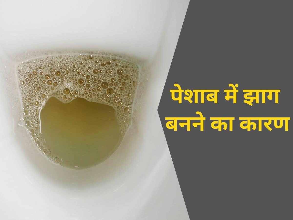 Peshab Me Jhag Aane Ke Karan | पेशाब में झाग आने का कारण हैं ये 5 ...