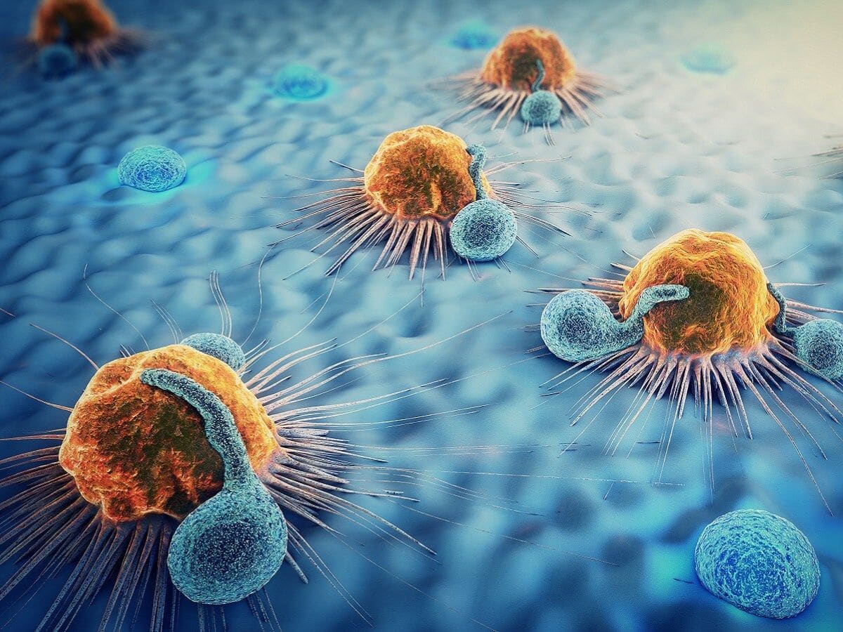 Cancer Symptoms In Women: Top 5 Unusual Signs of Cancer To Watch Out ...