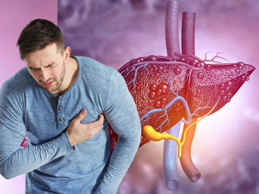 Liver Health And High Cholesterol: Here Is How Liver Damage Leads To ...