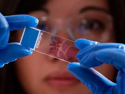 5 Common Pathology Myths Debunked: The Truth Revealed | TheHealthSite.com