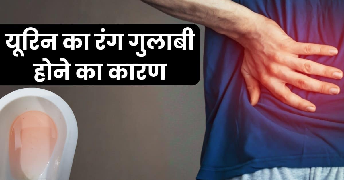 Peshab ka Rang Halka Lal hone ke Karan | पेशाब का रंग हल्का लाल होना इन ...
