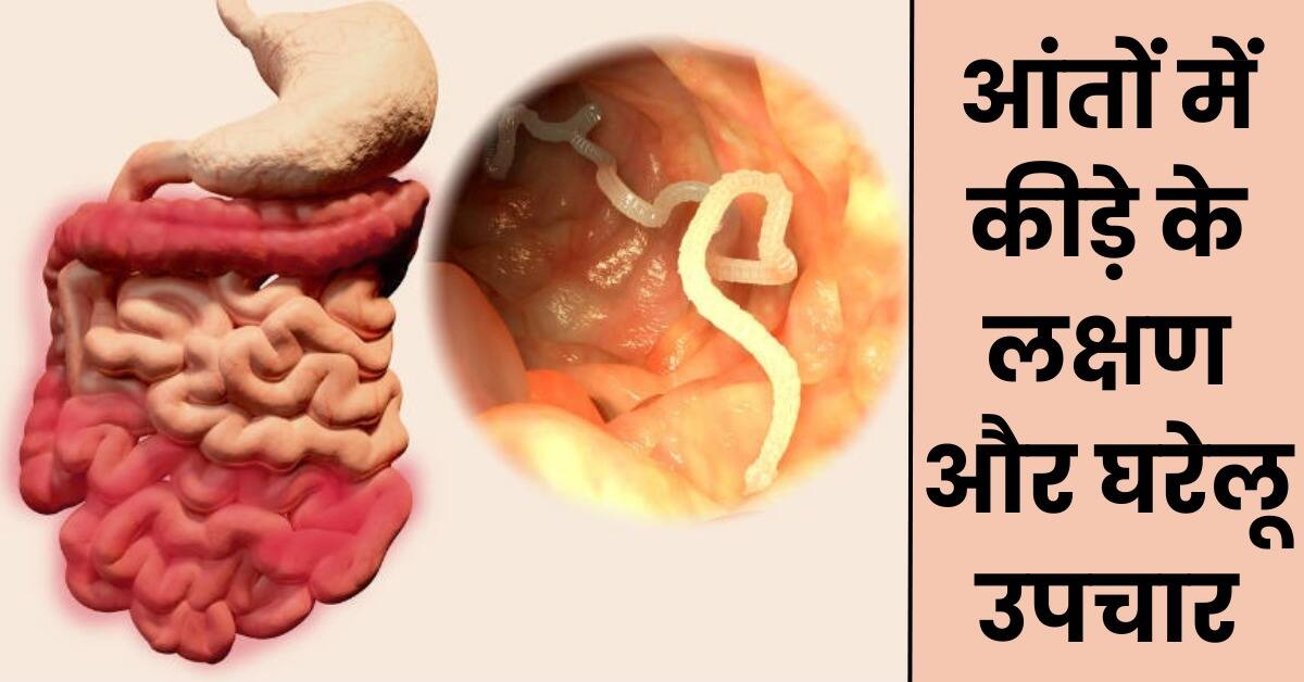 Aant me Kide Hone ke Lakshan | आंत में कीड़े होने पर शरीर देता है ये 5 ...