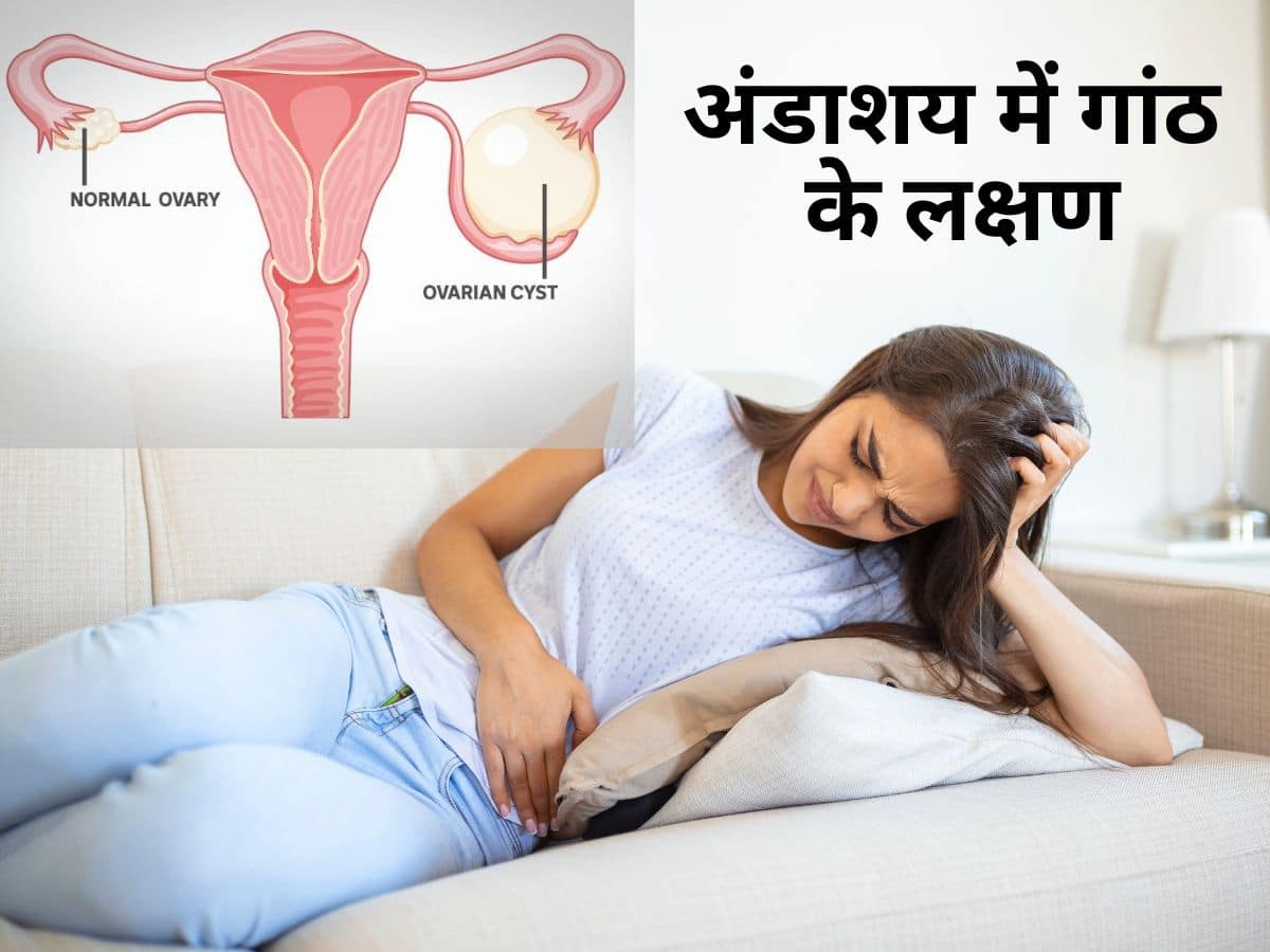 Andashay Me Ganth Ke Lakshan | महिलाओं के अंडाशय में गांठ होने के ...