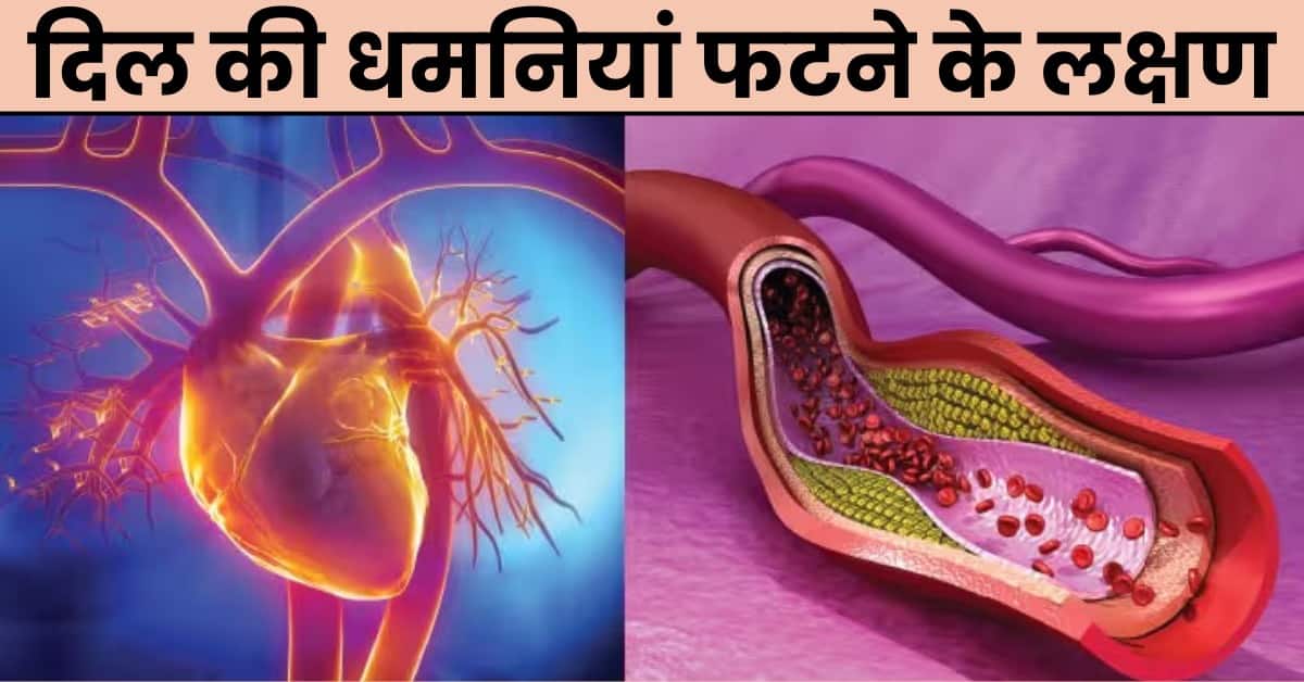 Dhamni Fatne ke Lakshan | धमनियों के फटने से पहले शरीर देता है ये 5 ...