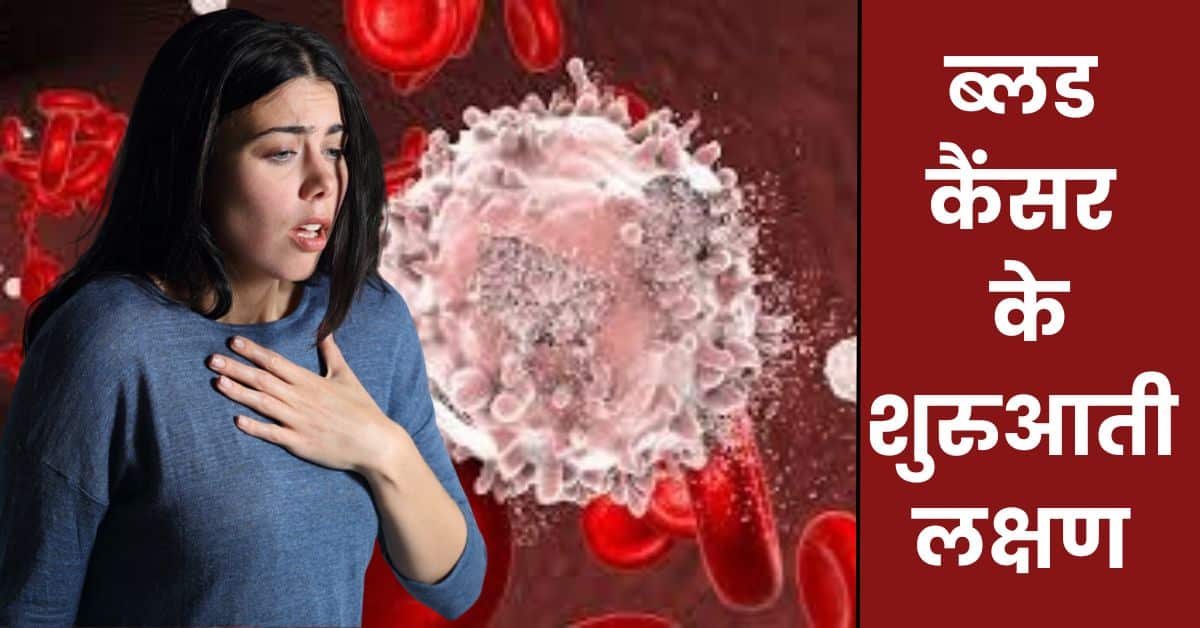 Blood Cancer Ke Lakshan | ब्लड कैंसर की शुरुआत होने पर शरीर में दिखाई ...