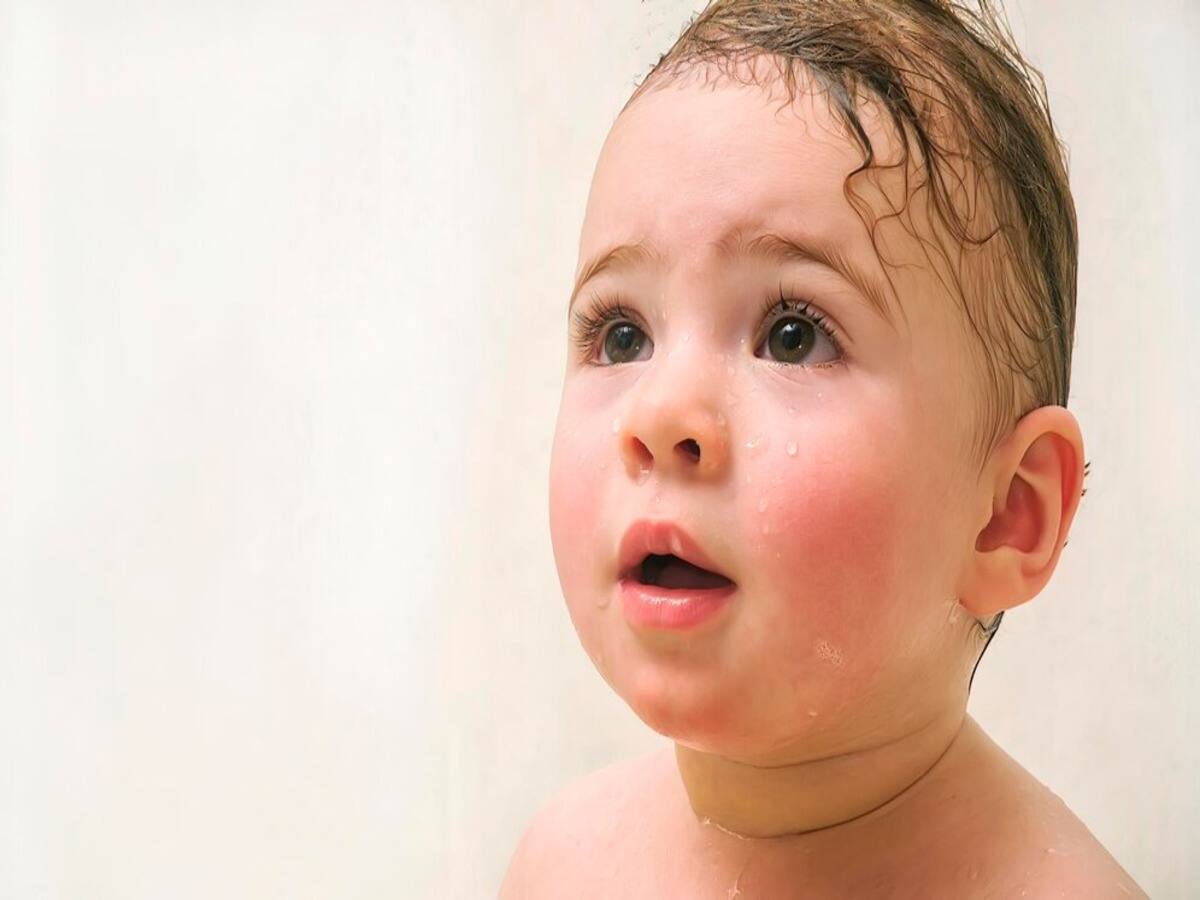 Parvovirus B19: Everything To Know About 'Slapped Cheek' Illness That ...