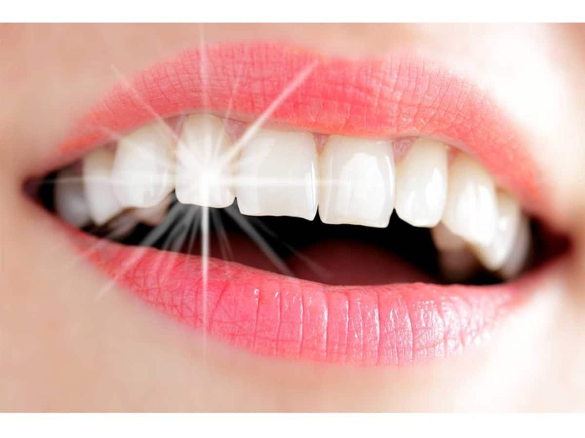 What bleaching can do for your teeth | TheHealthSite.com
