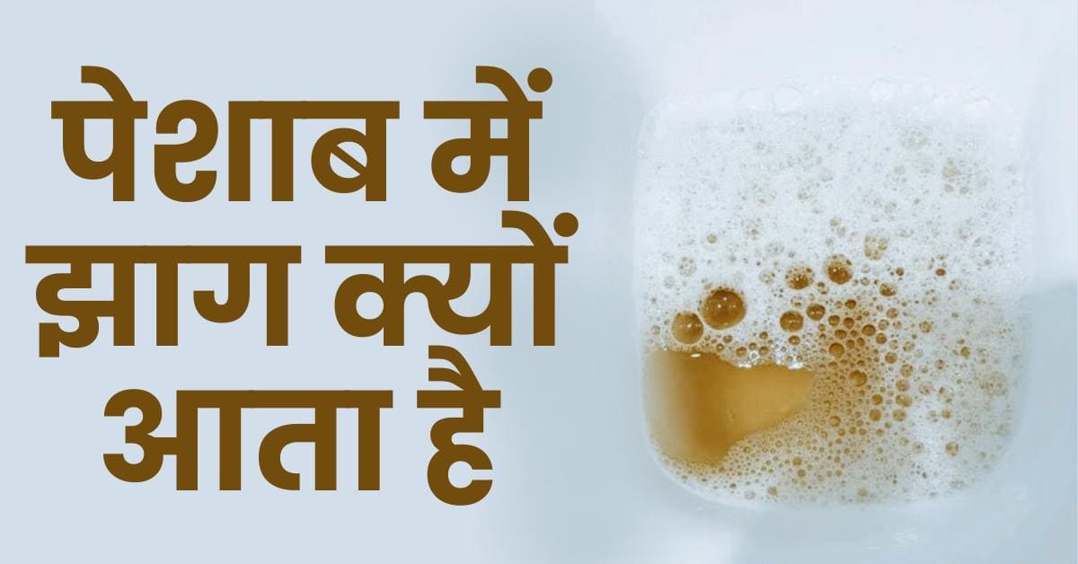 Peshab Mein Jhag Aana Kya Karan Hai | पेशाब में सफेद झाग का मतलब क्या ...