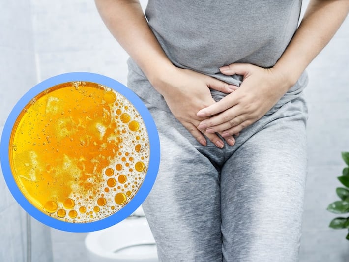Excessive Foamy Urine At Night: 5 Potential Diseases That Can Cause ...