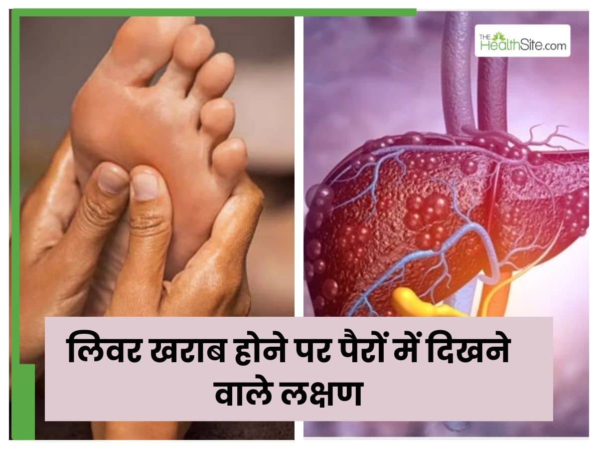 Liver kharab hone ke lakshan | ल‍िवर खराब होने पर पैरों में द‍िखते हैं ...