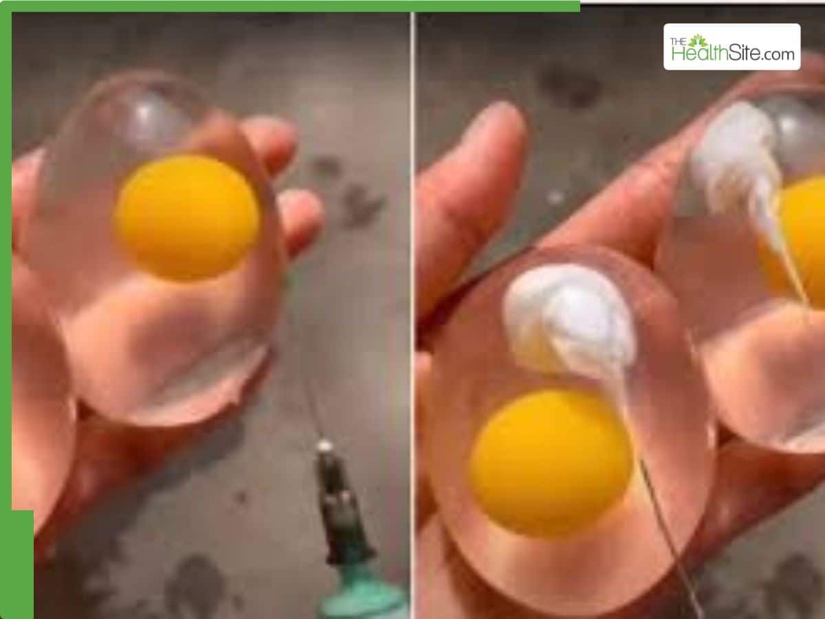 Fake Eggs Vs. Real Eggs: How To Identify Plastic Eggs, Health Risks They Can Cause ...