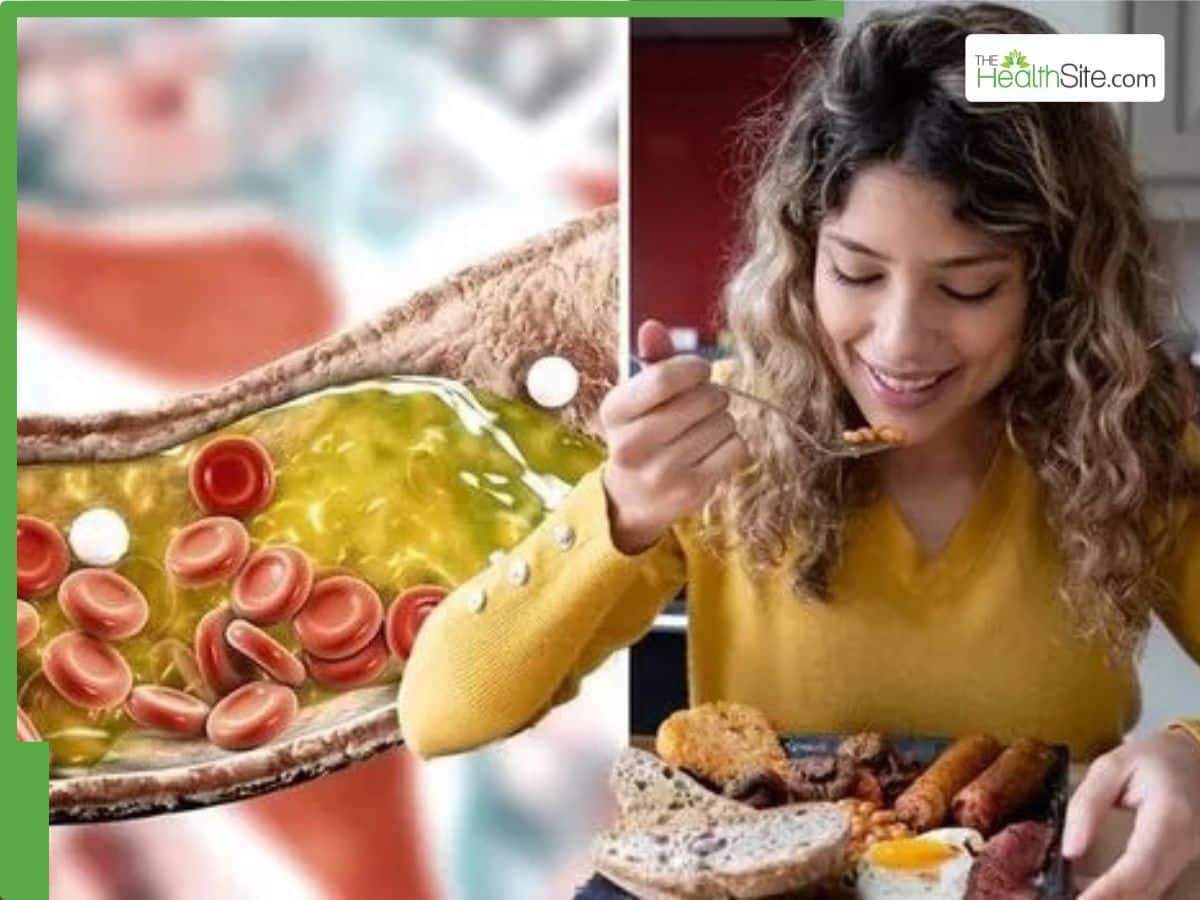 7 Heart-Healthy Fats to Naturally Lower Bad LDL Cholesterol | TheHealthSite.com