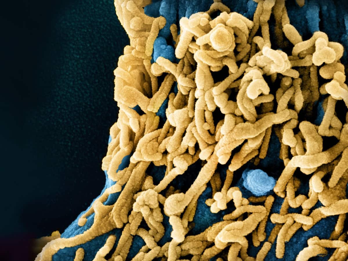 Marburg Virus Update: East Africa Heightens Surveillance As Rwanda ...