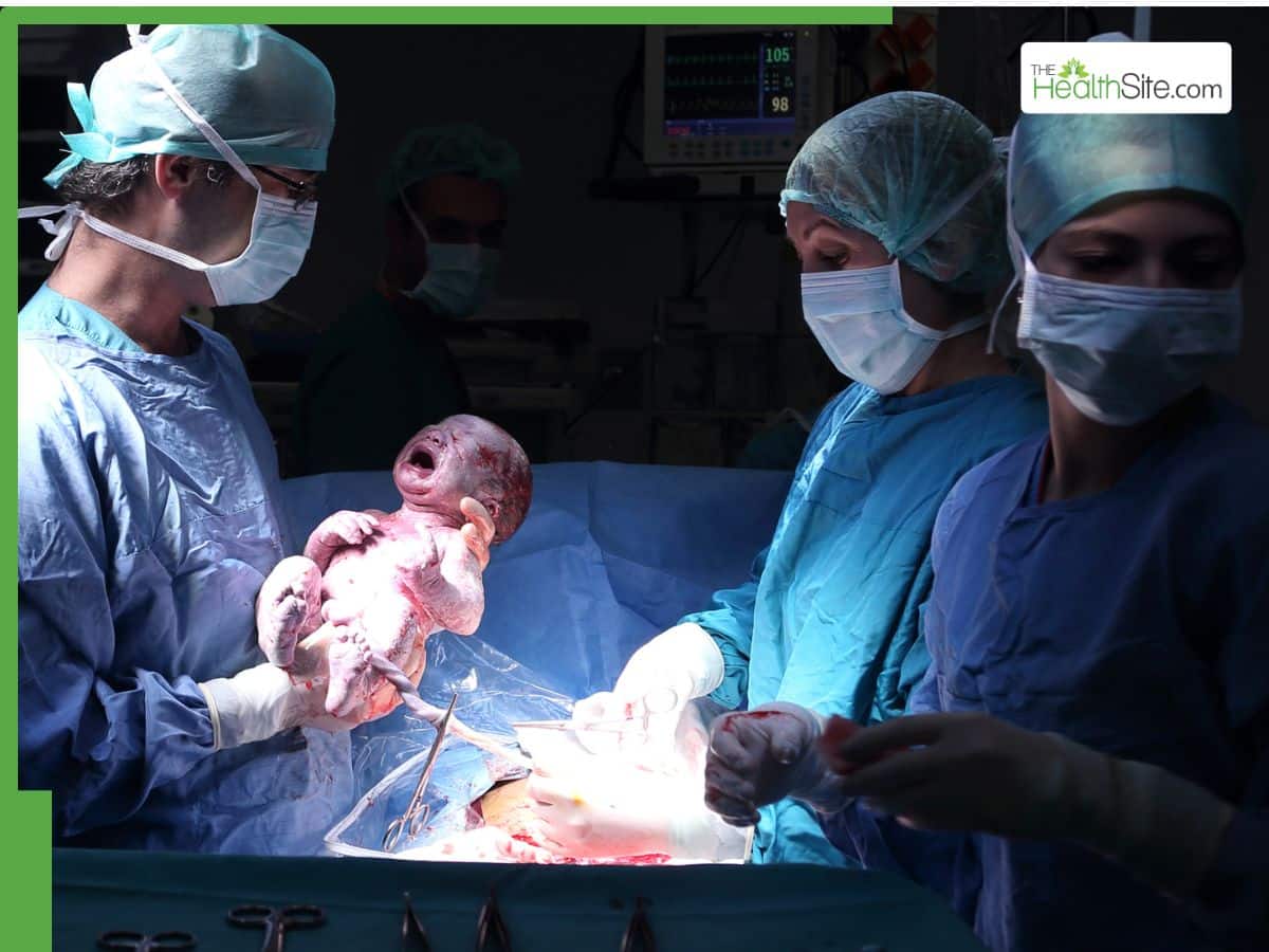 Exploring Vaginal Birth After Caesarean Section (VBAC): A Safe Option ...