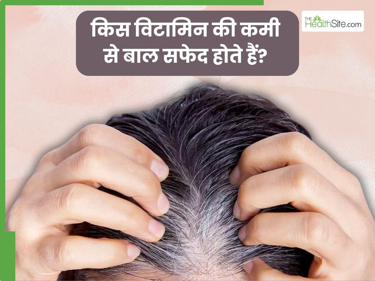 Kis Vitamin ki Kami se Baal Safed Hote Hain इस 1 विटामिन की कमी से उम्र ...