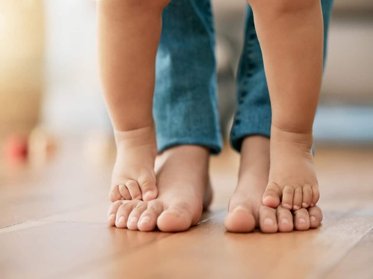 Medical Case: When A Preterm Twin Baby Was Born With A Foot Deformity ...