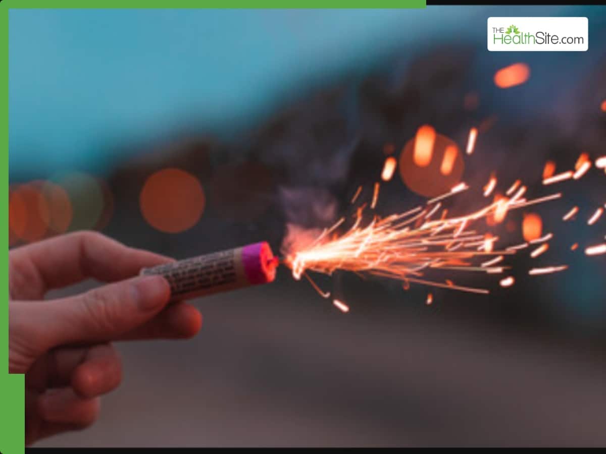 Firecrackers burning home remedies: दिवाली में पटाखों से जल गया हाथ, तो ...