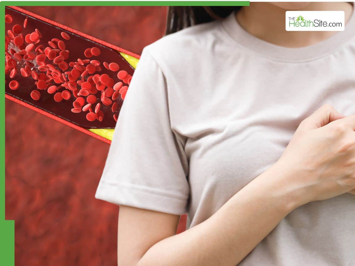 7 Tips To Clear Clogged Arteries And Prevent Plaque Formation Naturally ...