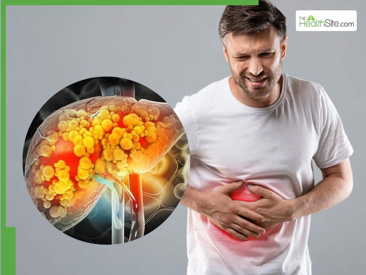 Liver Damage Symptoms At Night: Pale Stool And 5 Warning Signs Your ...