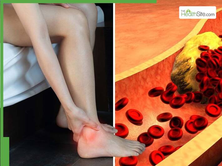 High Cholesterol Spike At Night: 5 Tips To Flush Out Bad LDL Naturally ...
