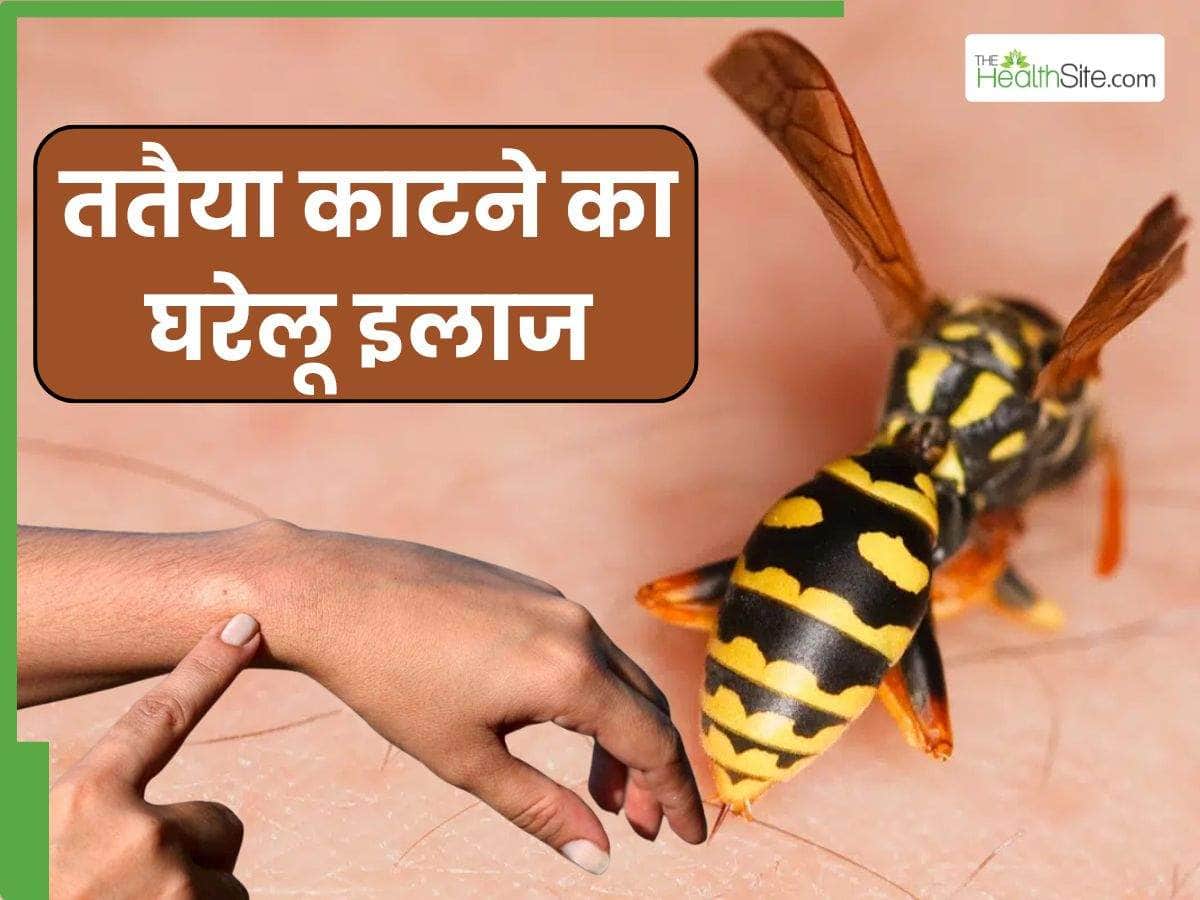 Tataiya Katne Ke Gharelu Upay | ततैया के काटने पर आजमाएं ये 5 घरेलू ...