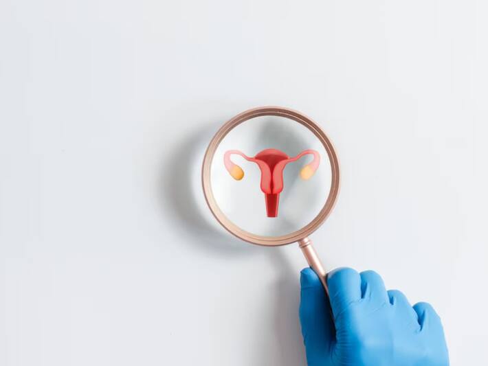 Cervical Cancer: Symptoms, Causes, Prevention Measures Of One Of The ...