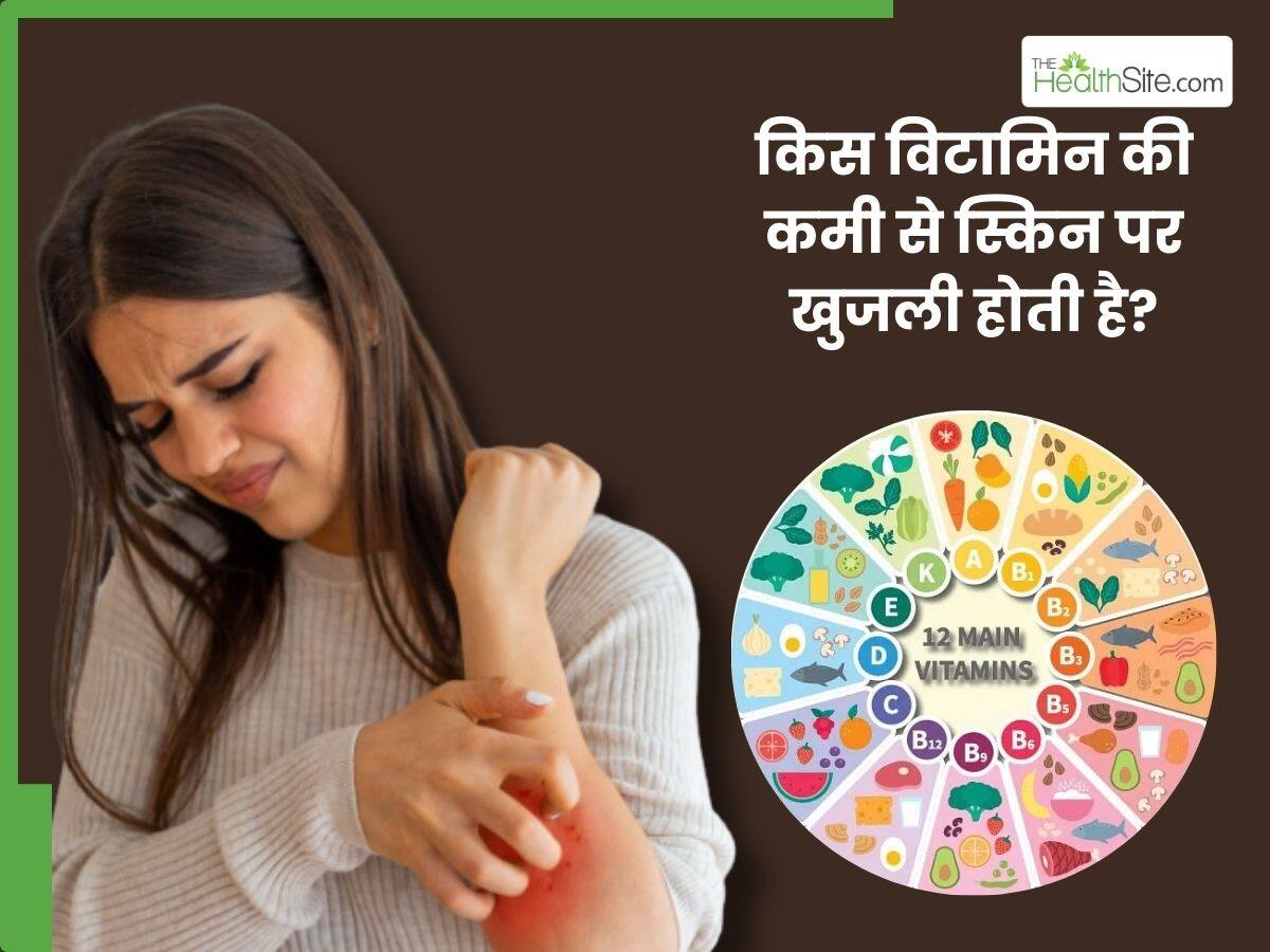 Kis Vitamin ki Kami se Khujli Hoti Hai | किस विटामिन की कमी से होती है ...
