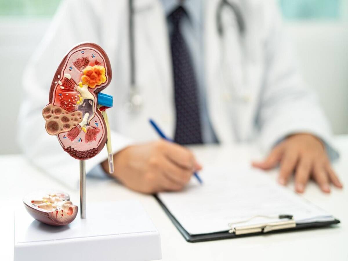 What Kind Of Lifestyle And Dietary Changes Can Prevent Kidney Stone ...