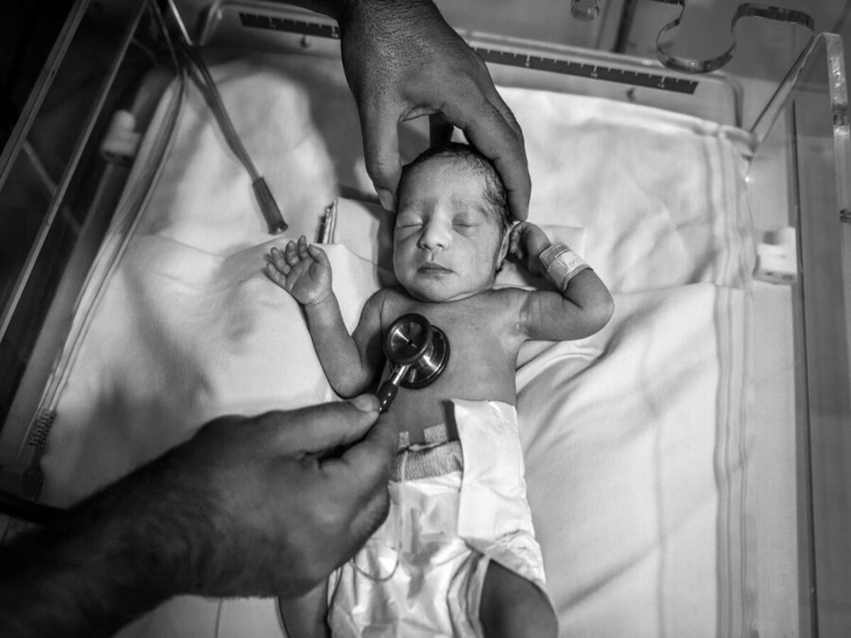 Rare Case: How Docs Saved The Life Of A Micro-Preemie Baby Born ...