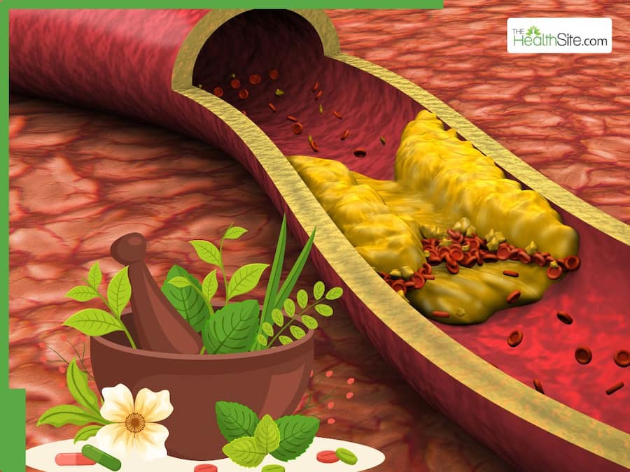 10 Medicinal Flowers To Lower High Cholesterol Levels Naturally Without ...