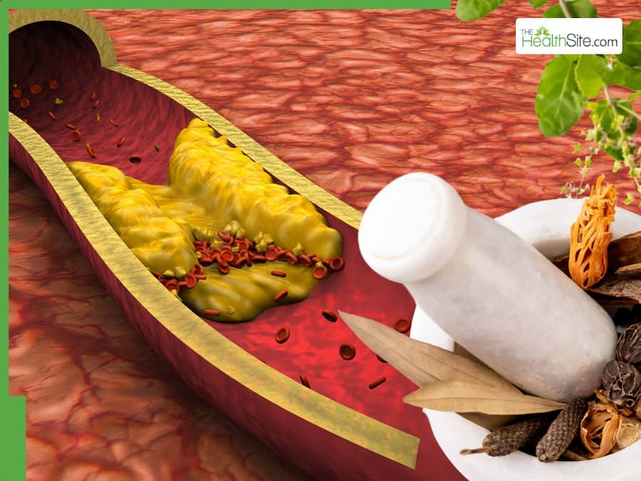 10 Medicinal Spices To Lower High Cholesterol Levels Naturally Without ...