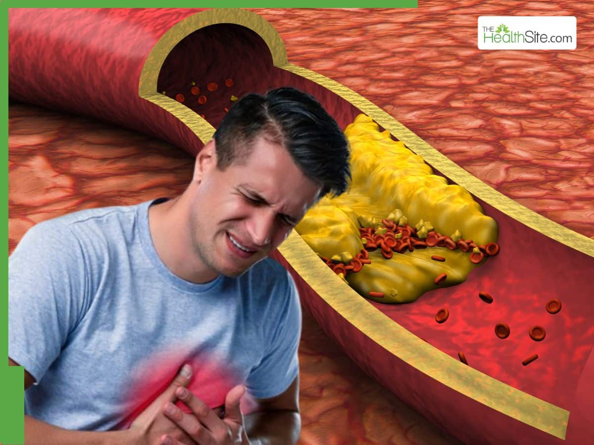 7 Warning Signs of Heart Attack That Appears In Your Eyes Before 1 ...