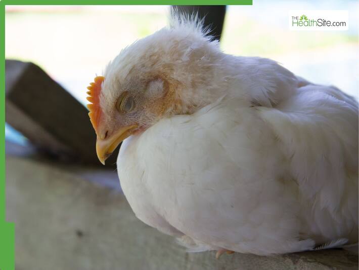 CDC Confirms First Severe Bird Flu Cases To Mystery Illlness grips ...