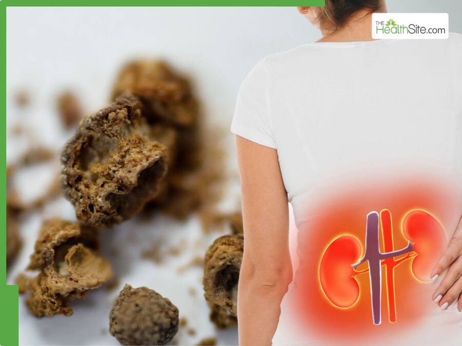 Kidney Damage Management Diet: 5 Yellow Coloured Superfoods To Keep ...