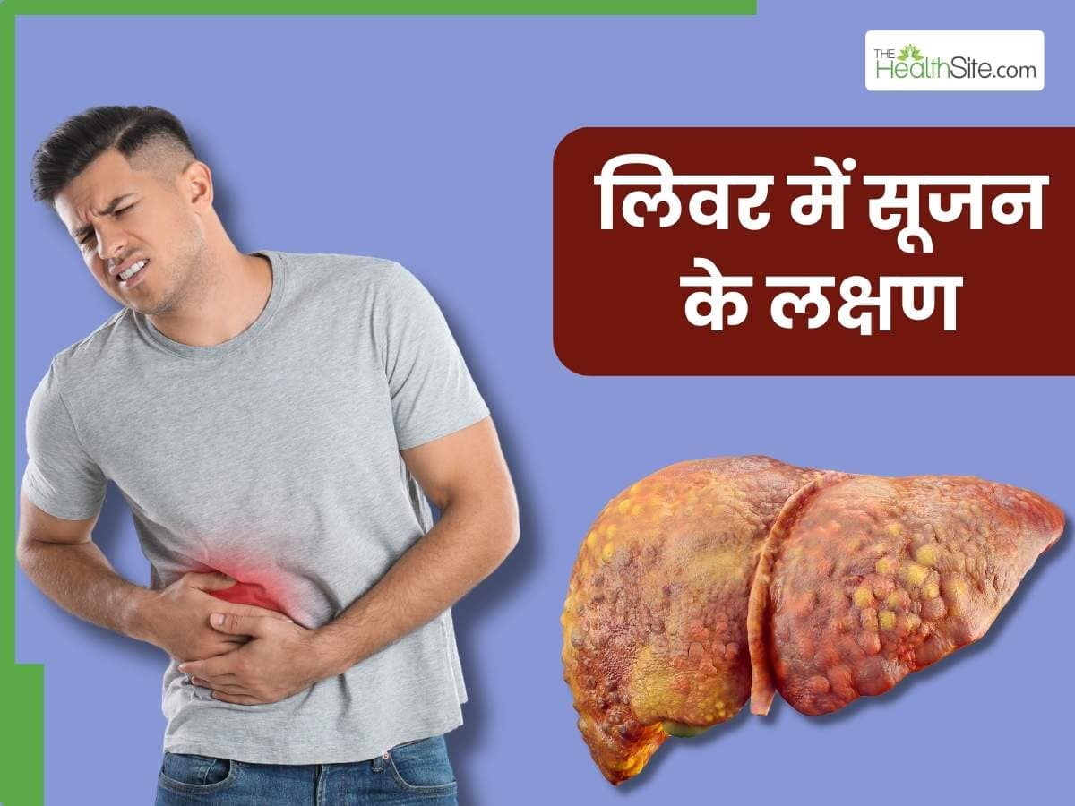Liver Me Sujan Ke Lakshan | लिवर में सूजन होने पर शरीर में दिखाई देते ...