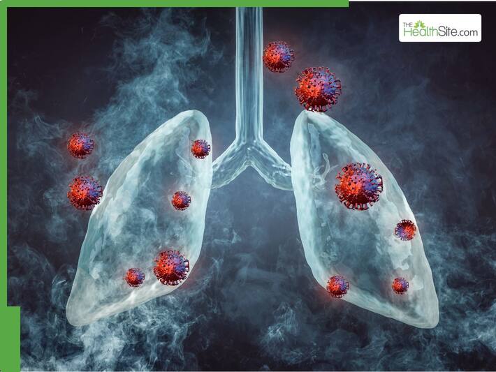 5 Dangerous Types of Cancer In The World And Their Symptoms ...