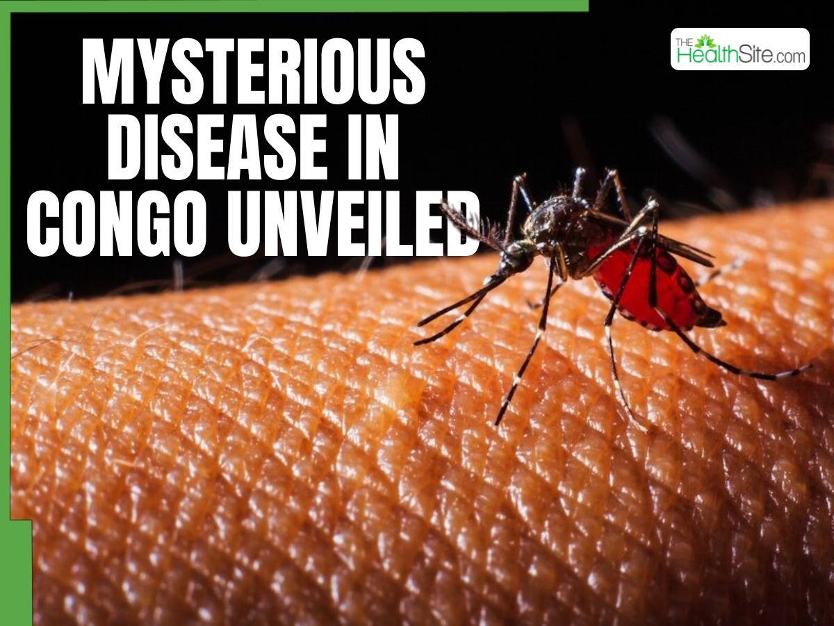 Mysterious Disease In Congo Unveiled; Know What Caused The Death Of 143 ...