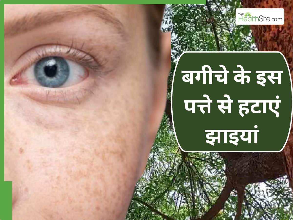 Jhaiya Kaise Hataye | बगीचे में लगे इस पेड़ के पत्तों से हटाएं जिद्दी ...
